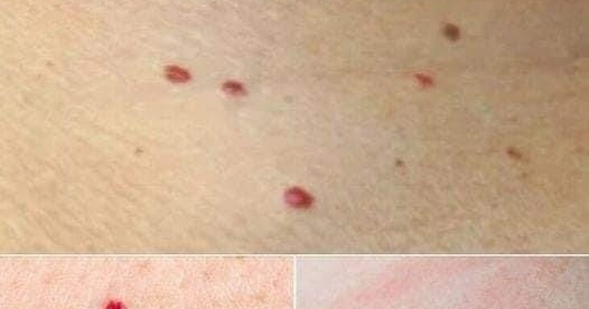 Red Dots on Your Skin: Causes and What They Could Mean - Athina360