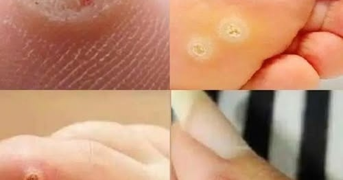 Να είστε πολύ προσεκτικοί: Αν παρατηρήσετε αυτό στο δέρμα θα μπορούσε ...