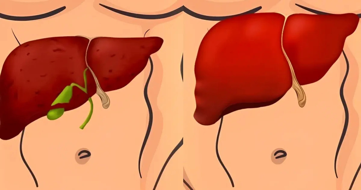 Φύλακες του ήπατος: 3 λαχανικά που «καθαρίζουν» και αποτοξινώνουν το ήπαρ - Athina360